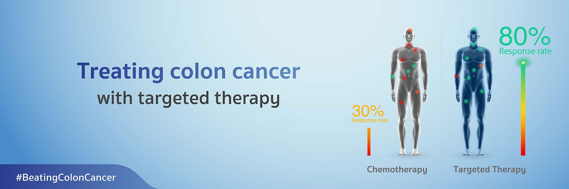 Colon Cancer