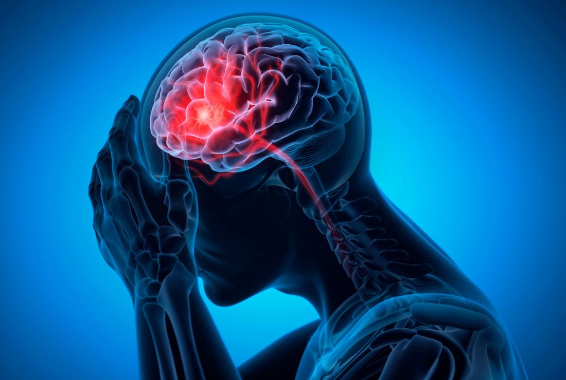 Stroke Screening Program